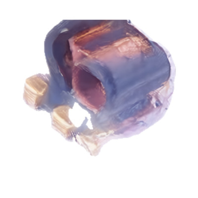 HenryTech H2TC2-112G2+ Balun Chip