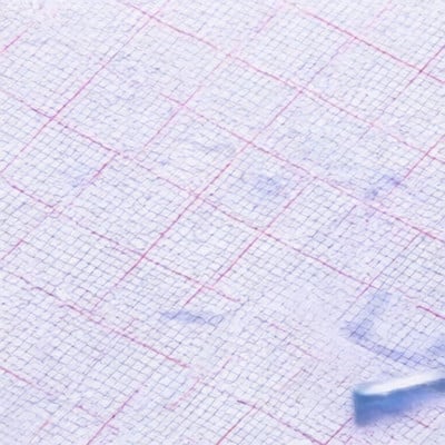 CCO(Chian Chia Elec) MF3WS-3KΩ±1% T
