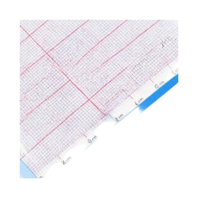 VISHAY MBB0207VD2000BC100 Through Hole Resistor