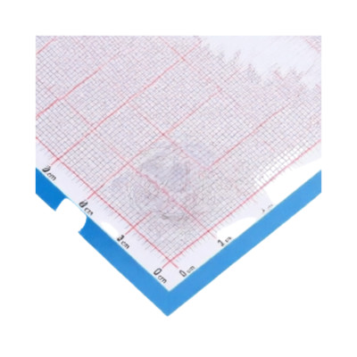 FOLLON EFRA6R3BK221M0605