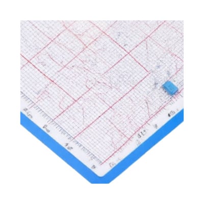 Dersonic CD2E105KC1IER1I100 Ceramic Capacitor